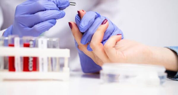 How Much Do Blood Tests at Home Cost in Dubai?